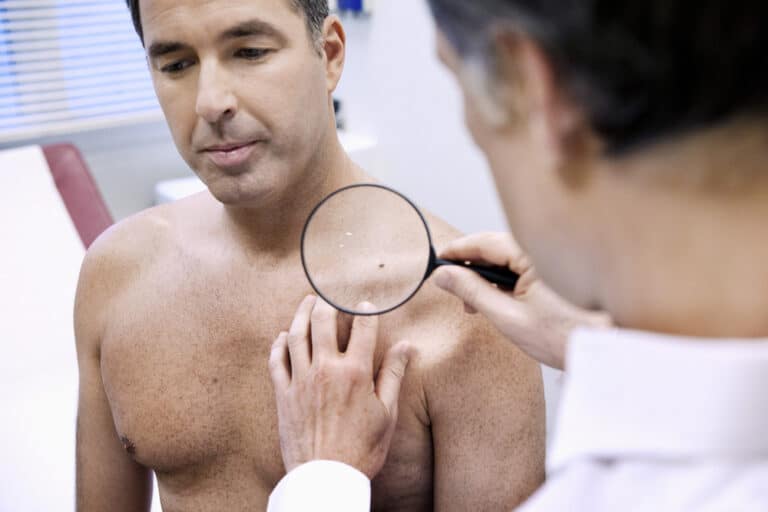 Skin Cancer Screening Frequency, Longhorn Dermatology, Spicewood, TX